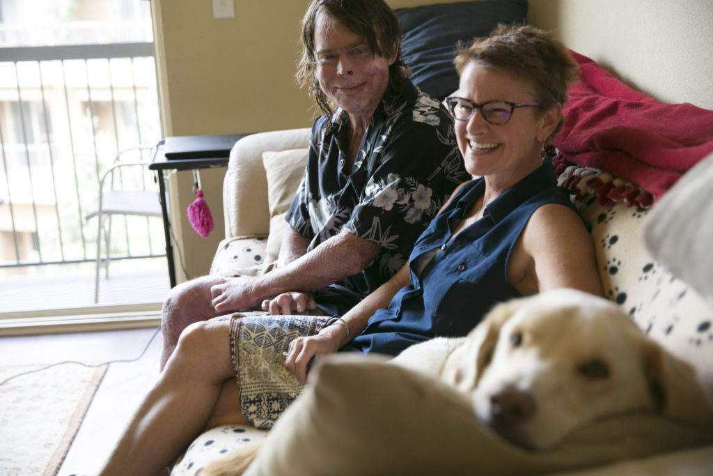 Doctors Said He Wouldn’t Survive His Burns. Now Dave Repsher’s Ready To ...