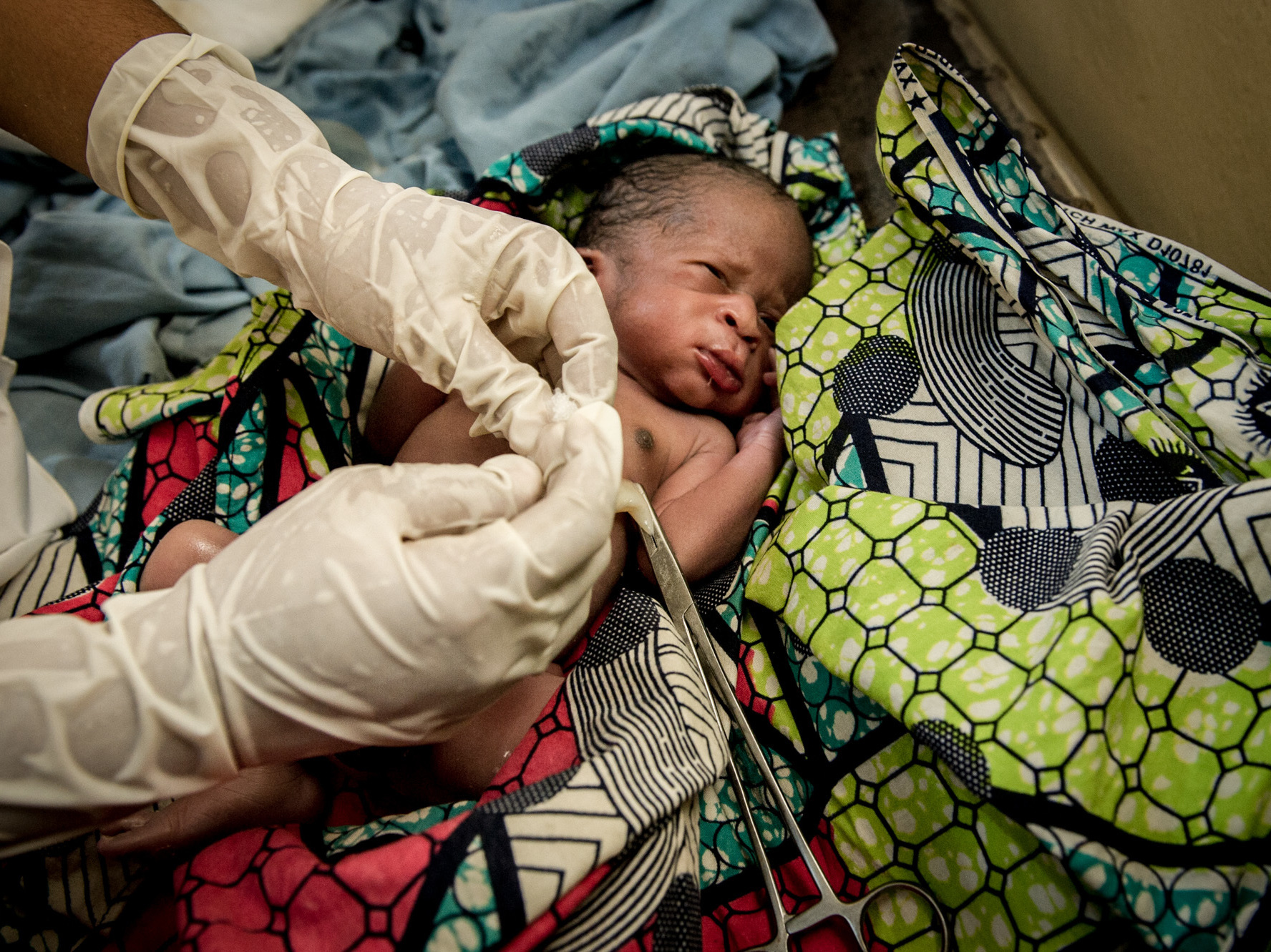 Contest For Biz Students Is All About Umbilical Cord Stumps | Colorado ...